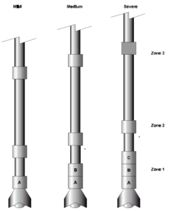 Types Of Bottom Hole Assembly (BHA) - DRILLING MANUAL